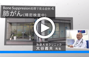 Bone Suppression処理（胸部骨減弱処理） | コニカミノルタ